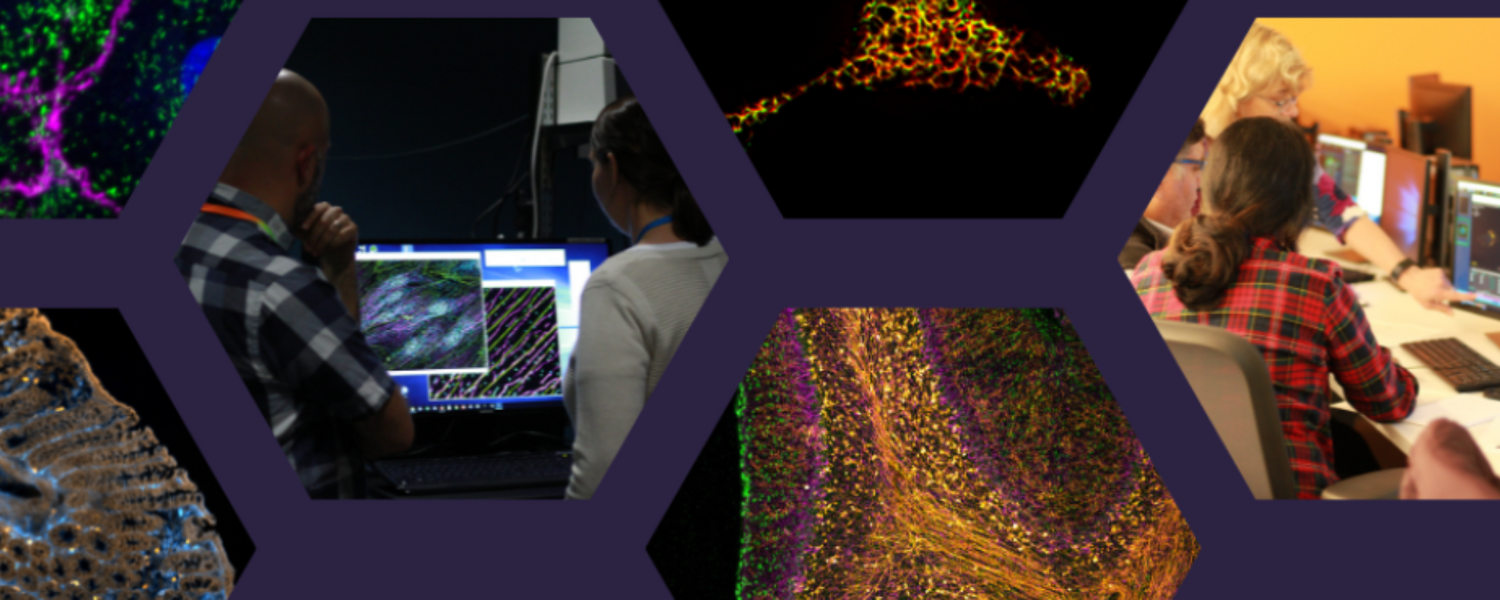 Driving Research | Live Cell Imaging Laboratory | Snyder Institute for Chronic Diseases ...